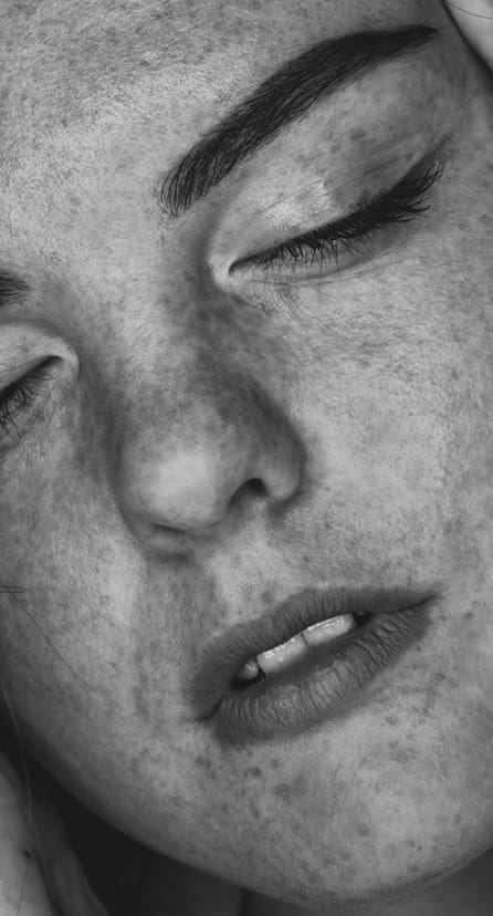 True Skin Analysis | Dermure Regenerative Skin & Laser Clinic